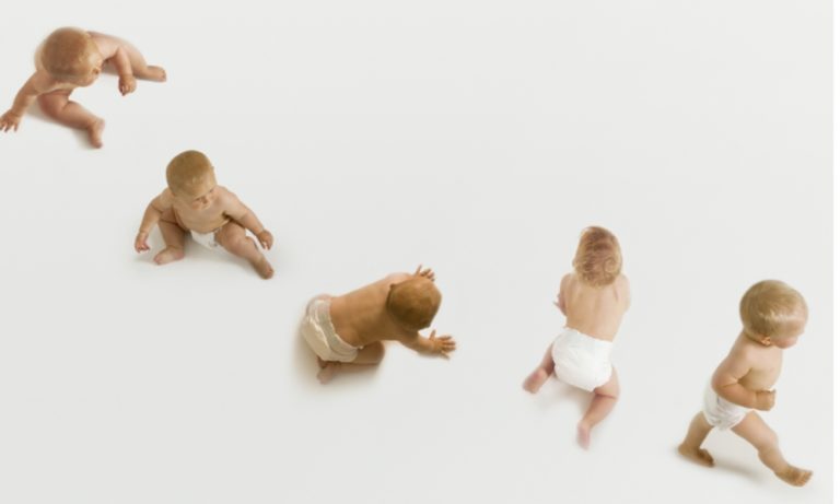 Do Babies Have Kneecaps? Risks And Complications Fact Sheet Do Babies Have Kneecaps? Risks And Complications Fact Sheet